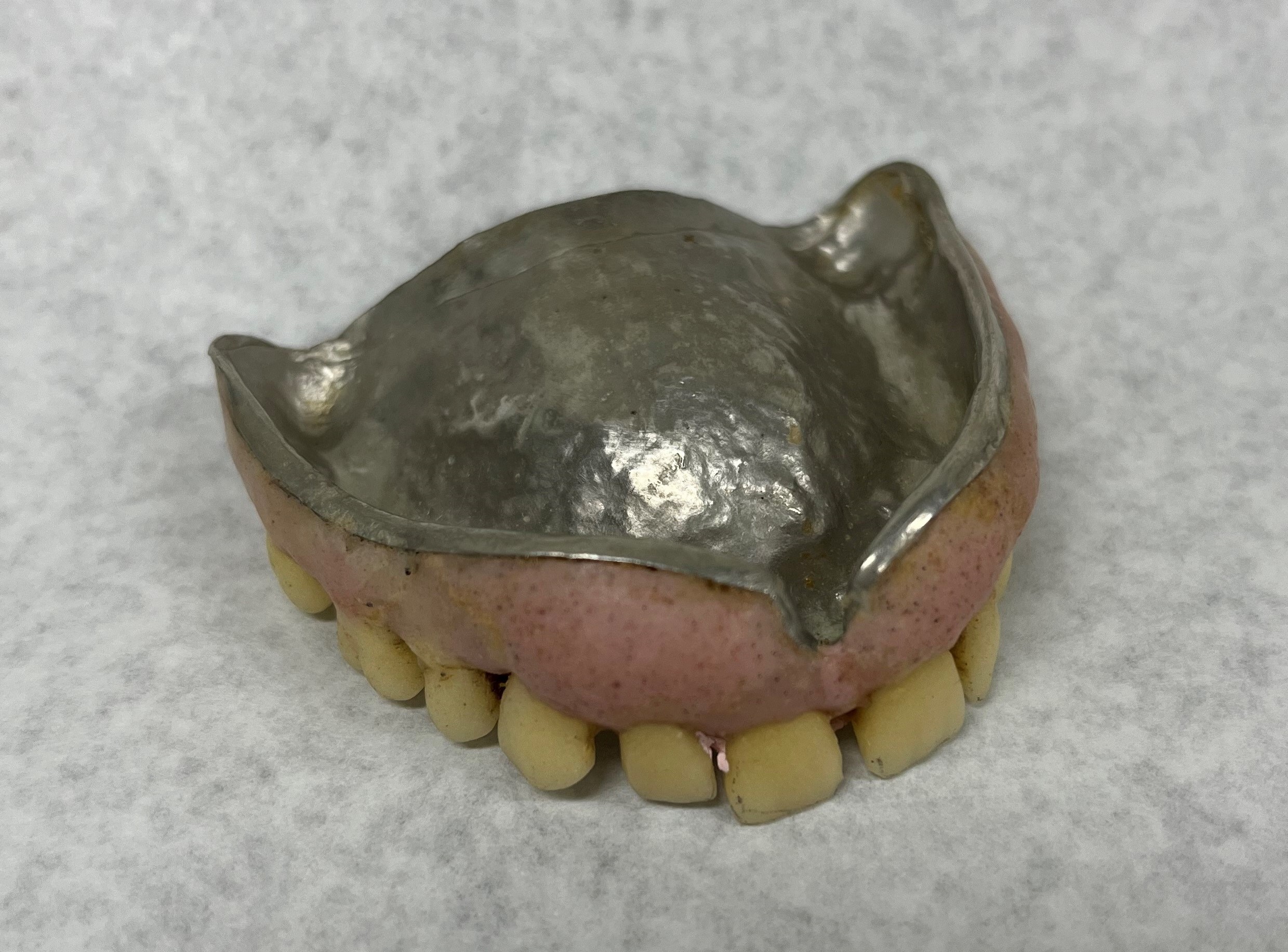 Platinum base porcelain face: the continuous gum denture